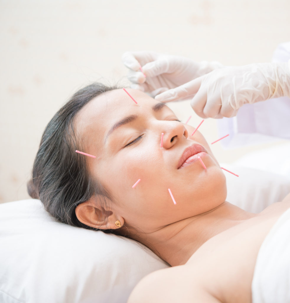 Cosmetic Acupuncture » Healing Arts Acupuncture | Burlington, ON